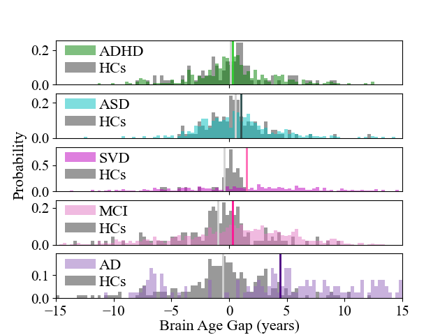 GitHub - zhaonann/brain-age-estimation-from-sMRI: Brain age estimation from sMRI based on multi ...